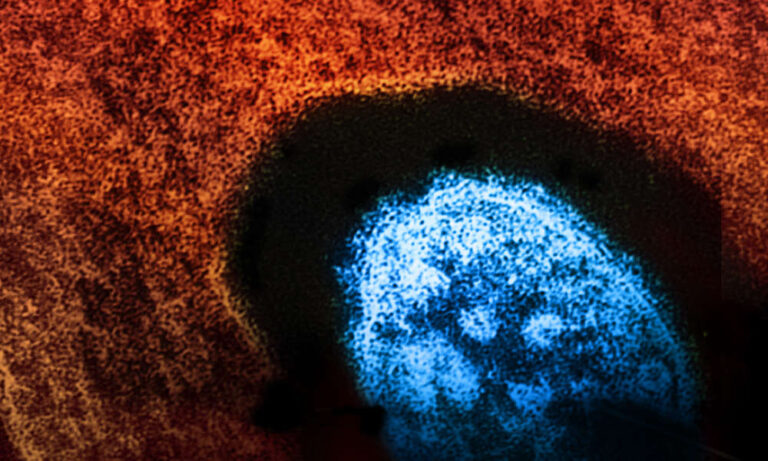 Connecticut reports 1st measles case of the year in unvaccinated child ...